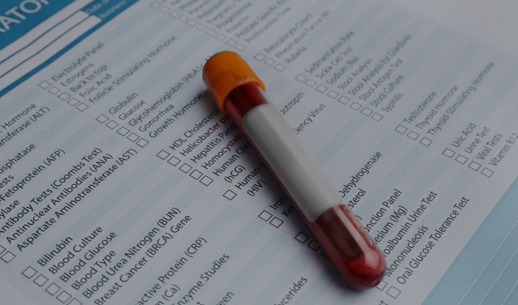 Extended Release Protein Study - Biofortis